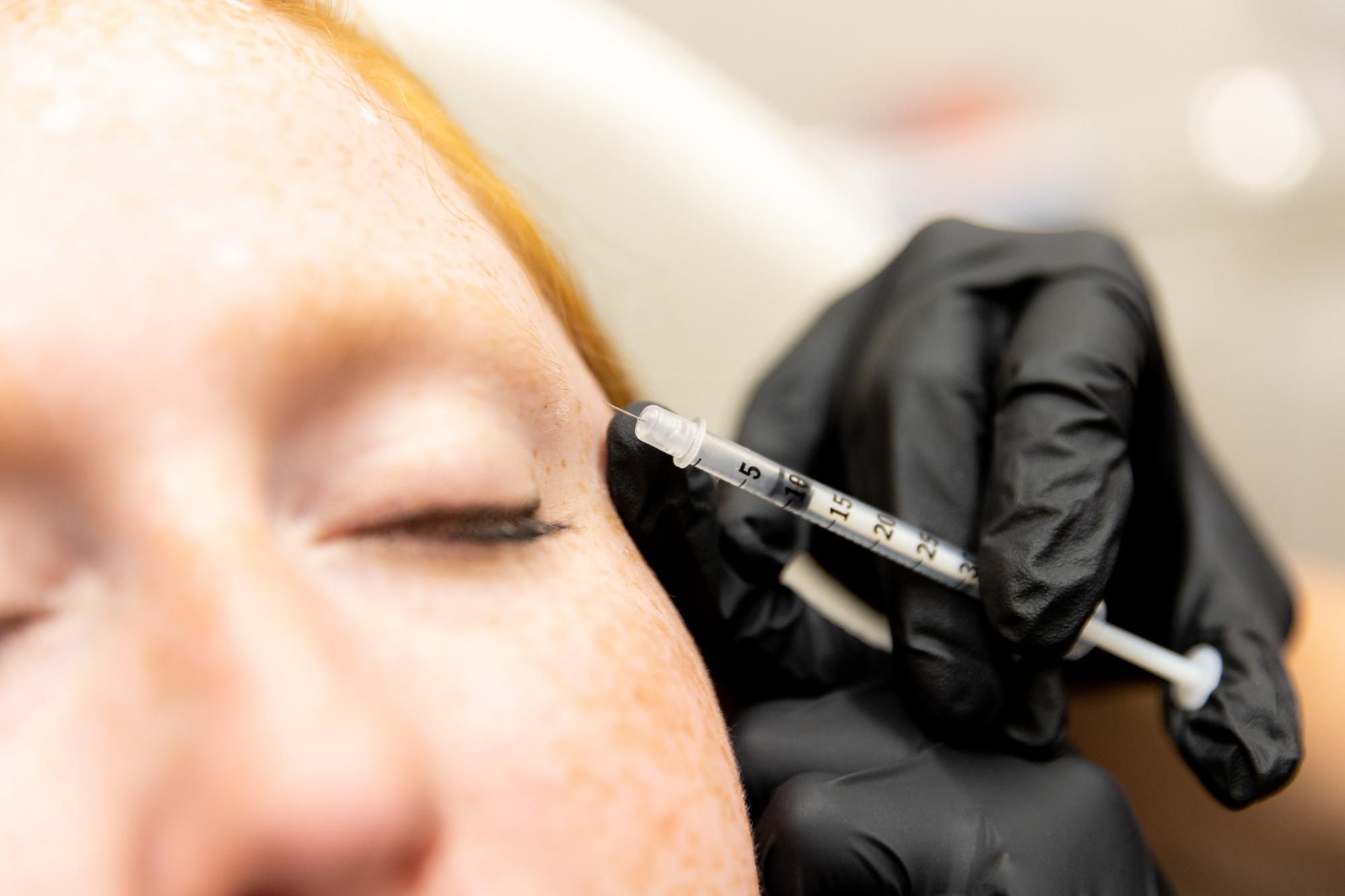 Botox in Carmel | Renova Aesthetics
